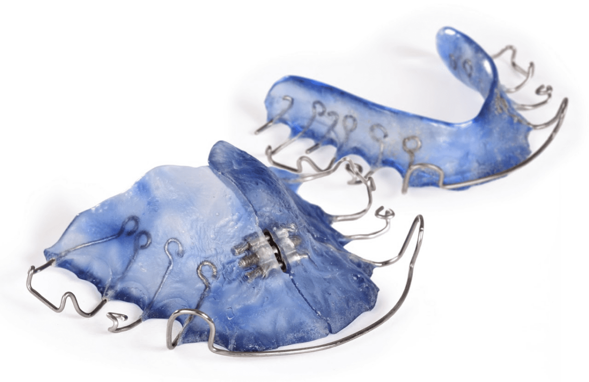 Fixing Retainer Gaps | Utah Orthodontic Care